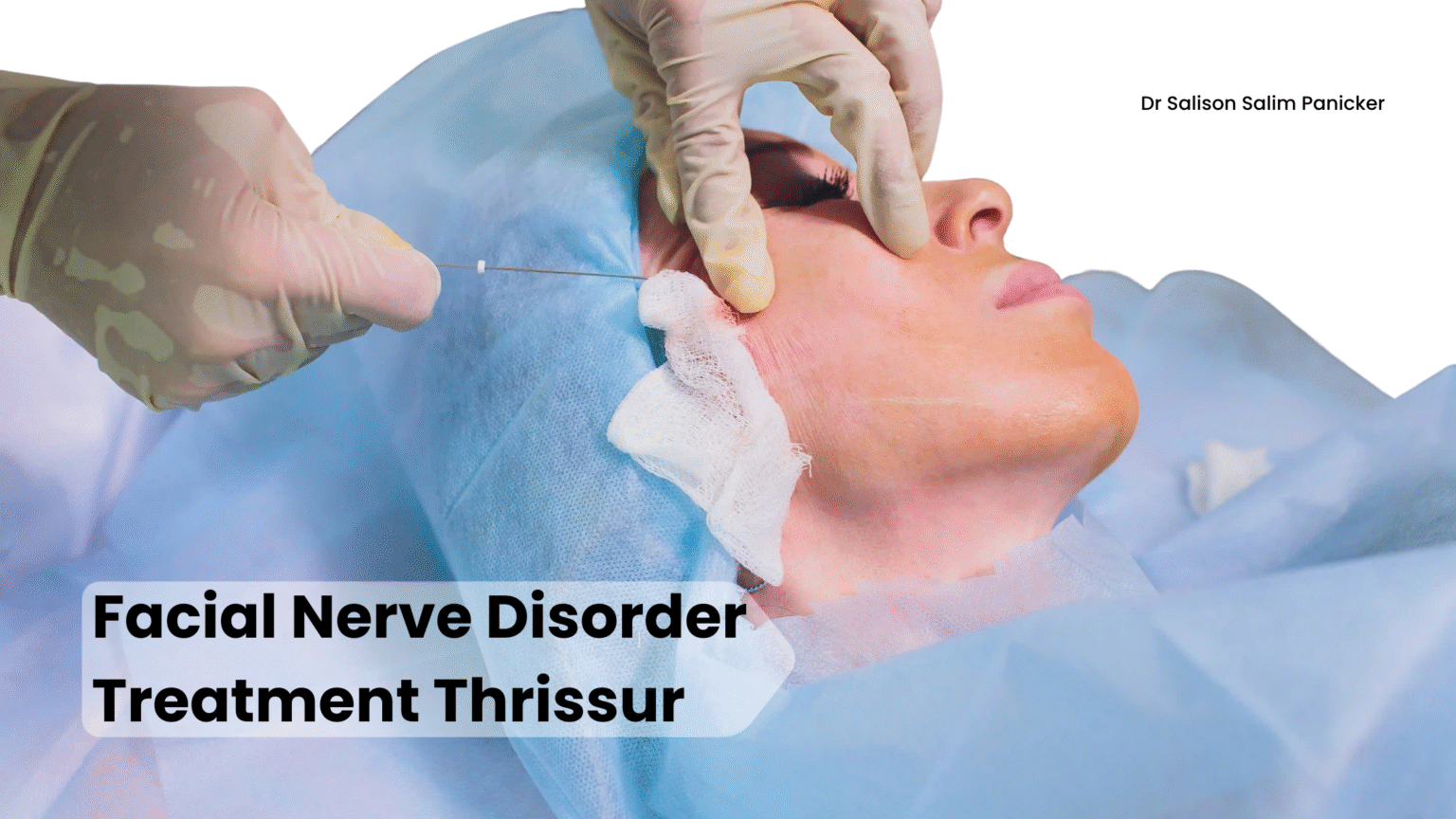 Facial nerve disorder treatment Thrissur - Dr Salison Salim Panicker